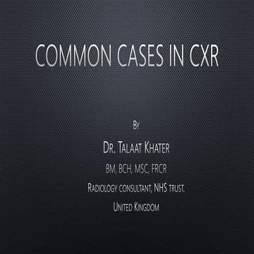 Common cases in CXR.pptx