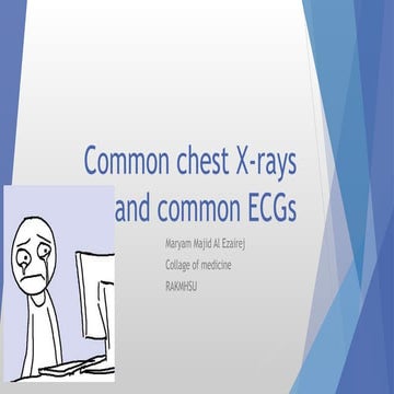 Common chest x rays and common ecgs | PPT
