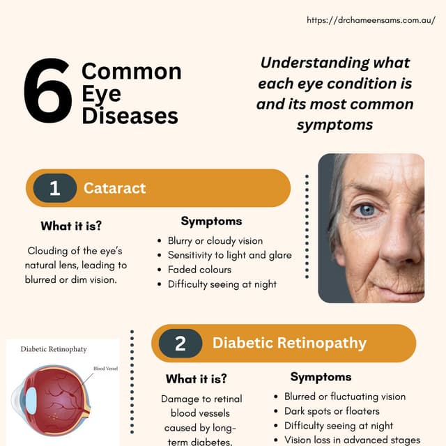 Common Eye Diseases and Symptoms - Dr. Chameen Sams Australia | PDF