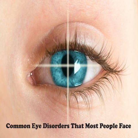Common eye disorders that most people face | PDF | Eye and Vision ...