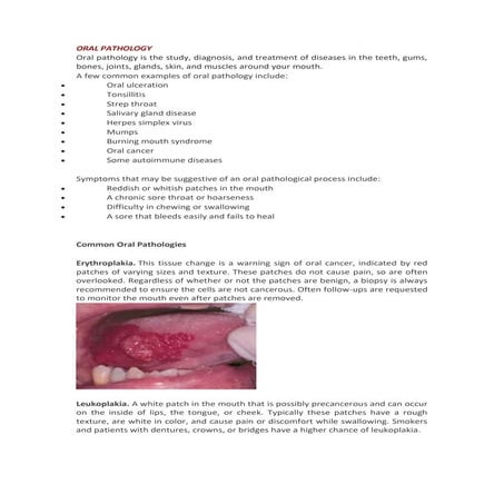 Common Oral Pathological Conditions.doc