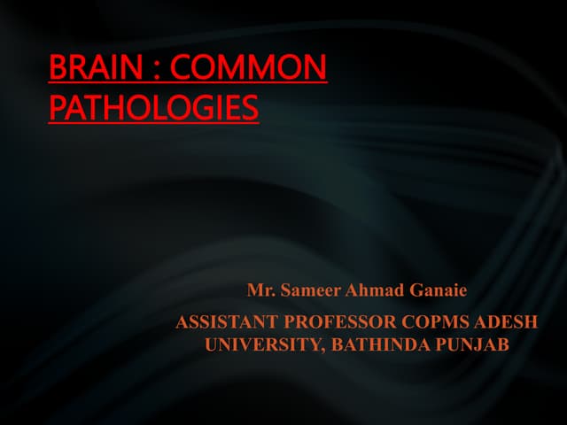 Imaging of Non Traumatic Intracranial Bleeding.pptx