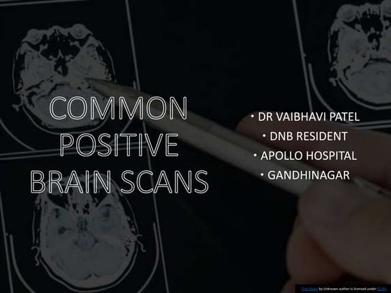 Brain mri reports | DOC