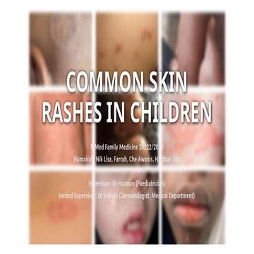 rashes - different types of rashes & diagnosis | PPTX