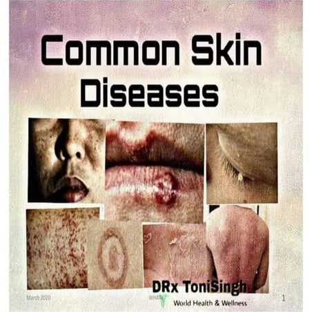 Most Common skin diseases drx_tonisingh | PDF