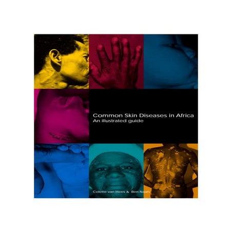 Common Skin Diseases in Africa Illustrated Guide 2001.pdf