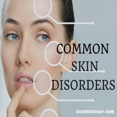 Common Skin Disorders | ODP