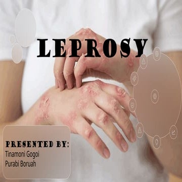 Leprosy | PPT