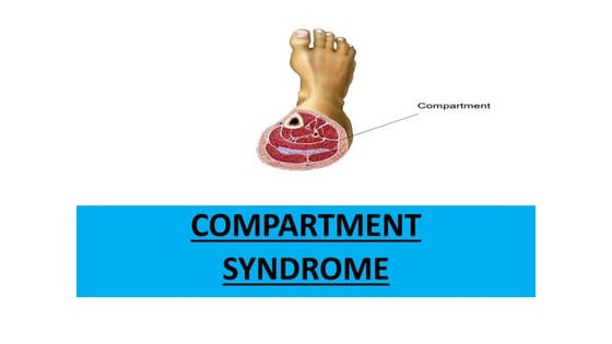 compartment syndroms 1..pptxXXXXXXXXXXXX | PPT