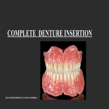 Complete-Denture-Insertion.pptxszdfxghjkl | PPTX
