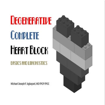 Degenerative complete heart block: basics and diagnostics | PDF
