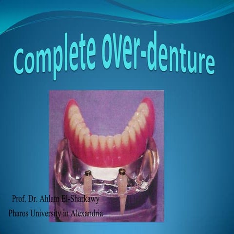 Complete overdenture(3) | PDF