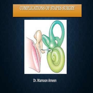 Complications of stapes surgry | PPTX