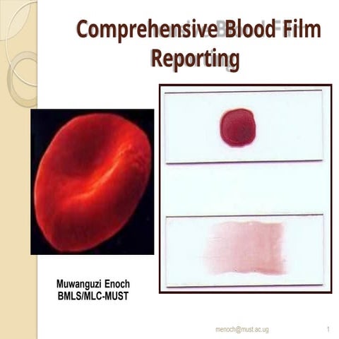 Peripheral smear | PPTX