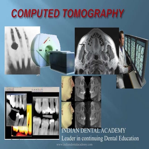 Computed tomography / dental implant courses | PPTX