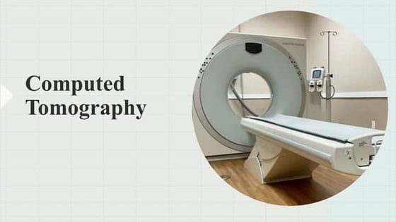 Ct stonogram-final-slide-share (Amponin & Carampatan) | PPTX