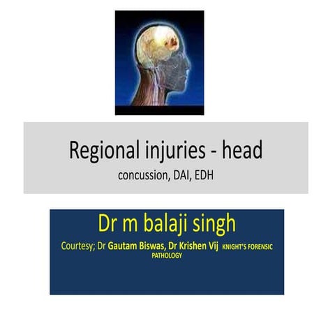 contre coup injury,Concussion,DAI, EDH- forensic aspects | PPTX