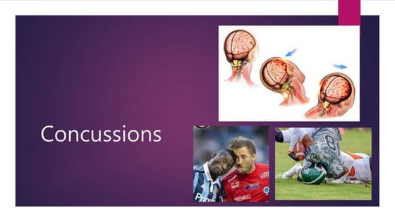 Recognizing and Managing Different Types of Concussion | PDF