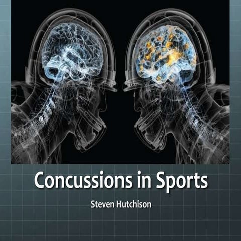 Concussions in Sports | PPTX