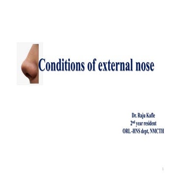 Condition of external nose dr rk | PPTX