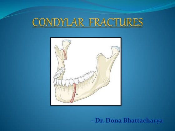 Mandibular fractures | PPTX | Death, Injury, or Military Conflict ...