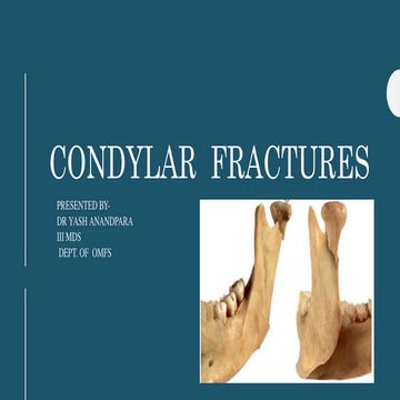CONDYLAR FRACTURES AND ITS MANAGEMENT.pptx
