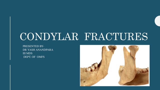 CONDYLAR FRACTURE.pptx
