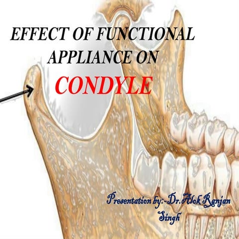 condylar growth in orthodontics and dentofacial orthopaedics | PPTX