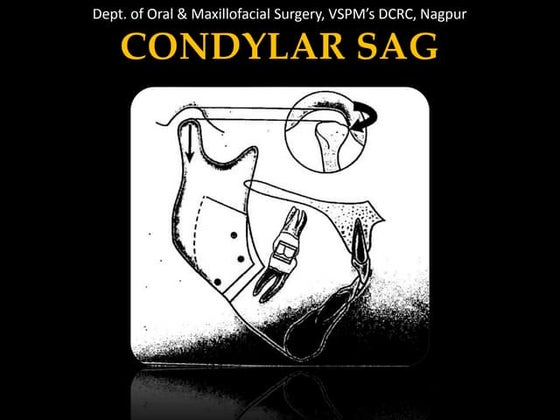 reproducibility of the condylar position indicator | PDF