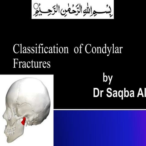 Condylar fractures | PPTX