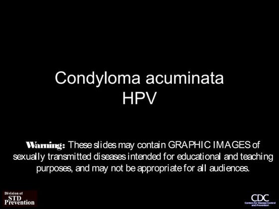 Genital warts | PPTX | Skin and Dermatology | Diseases and Conditions