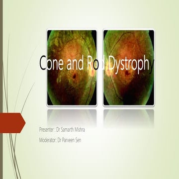 Cone and Rod Dystrophy | PPTX