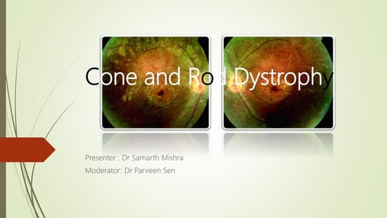 Mnemonics of Ophthalmology III | PPT