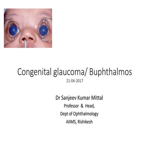 congeital_glaucoma.pptx