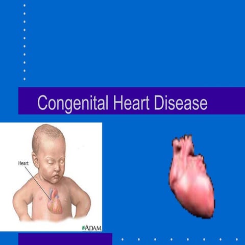 Congenital heart disease