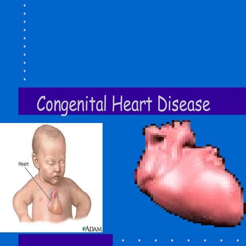 Congestive heart failure CHF | PPTX