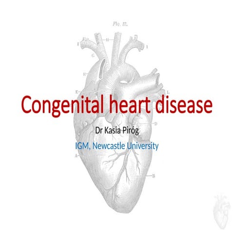 DiGeorge Syndrome (DGS).pdf