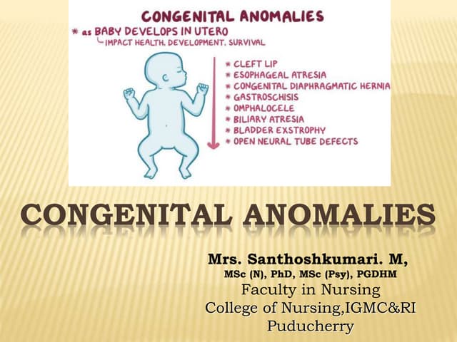 Congenital Anomalies Neural Tube Defects Birth Defects Ppt
