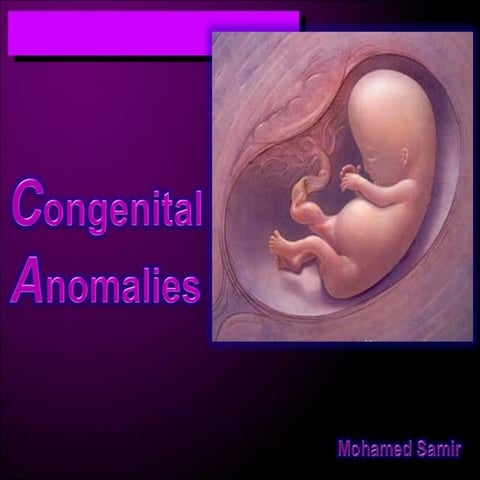 Congenital anomalies ii | PPT