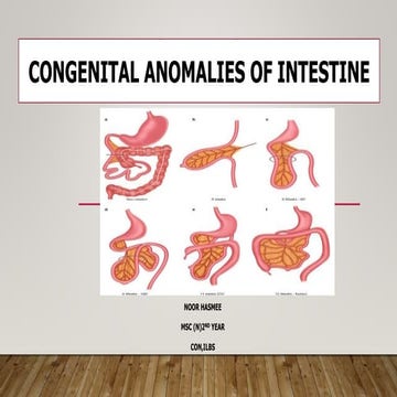 congenital anomalies of intestine ppt.pptx