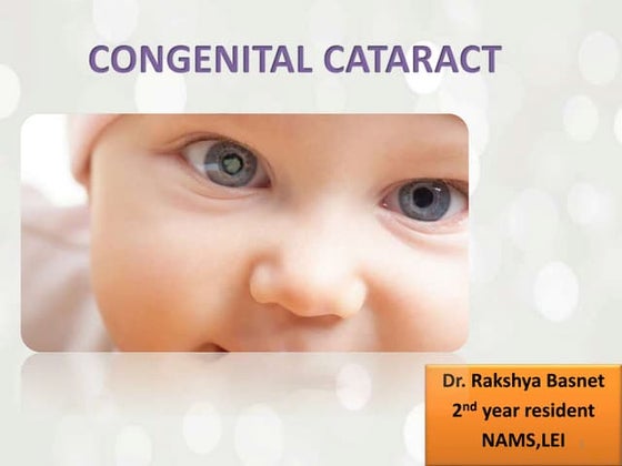 Congenital cataract | PPTX | Eye and Vision Conditions | Diseases and ...