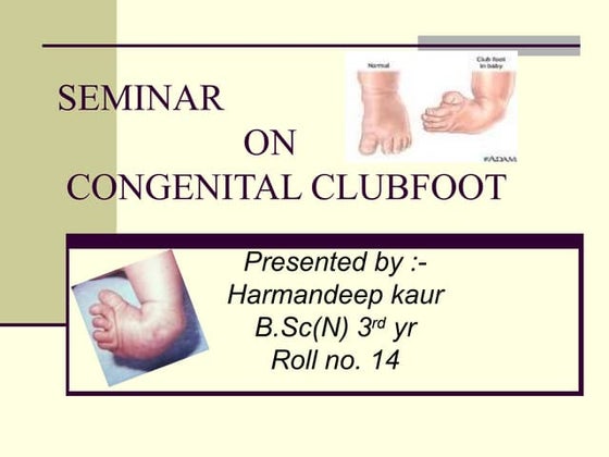 Congenital Talipes Equino Varus Deformity | PPT