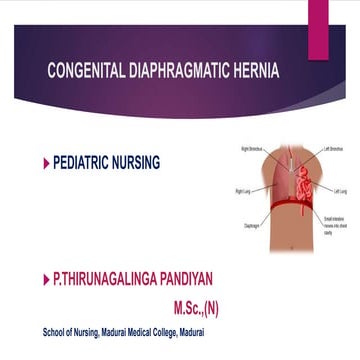 Congenital Diaphragmatic Hernia | PPTX
