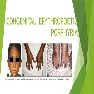 CONGENITAL ERYTHROPOETIC PORPHYRIA.pptx