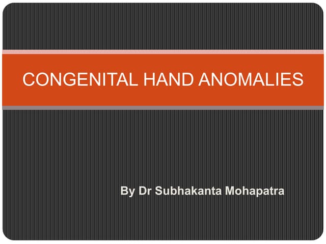 Congenital hand deformities copy | PPTX