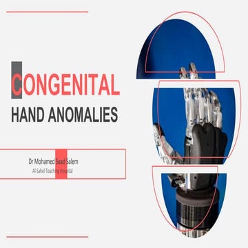 congenital hand anomalies sa3d.pptx | Infertility | Reproductive Health