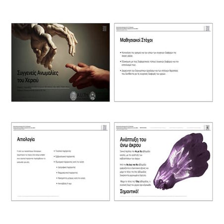 Congenital Hand Deformities Teaching.pdf