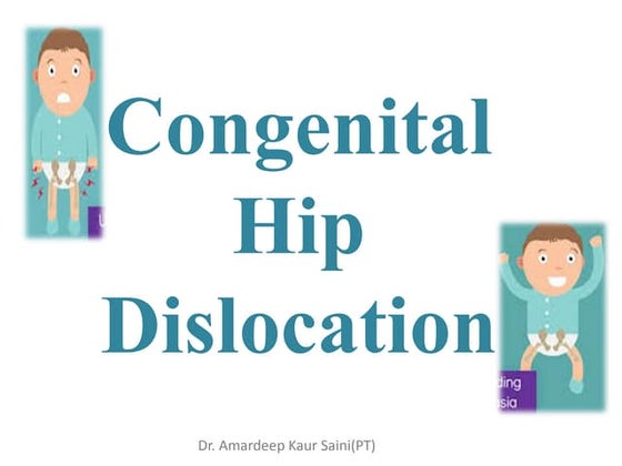 Congenital Dislocation of the Hip - PHYSIOTHERAPY | PPT