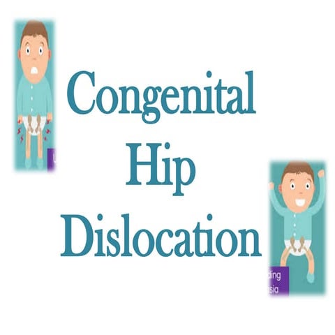 congenital hip dislocation .pptx
