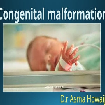 congenital malformation in pediatric.pptx
